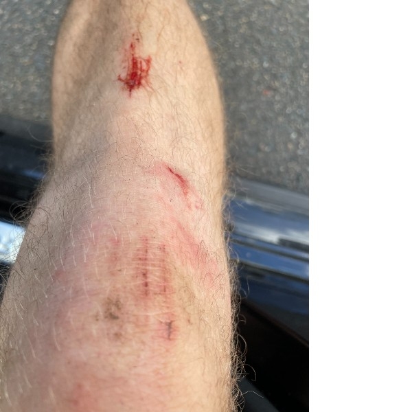 Can Too Foundation - Gary Worrell